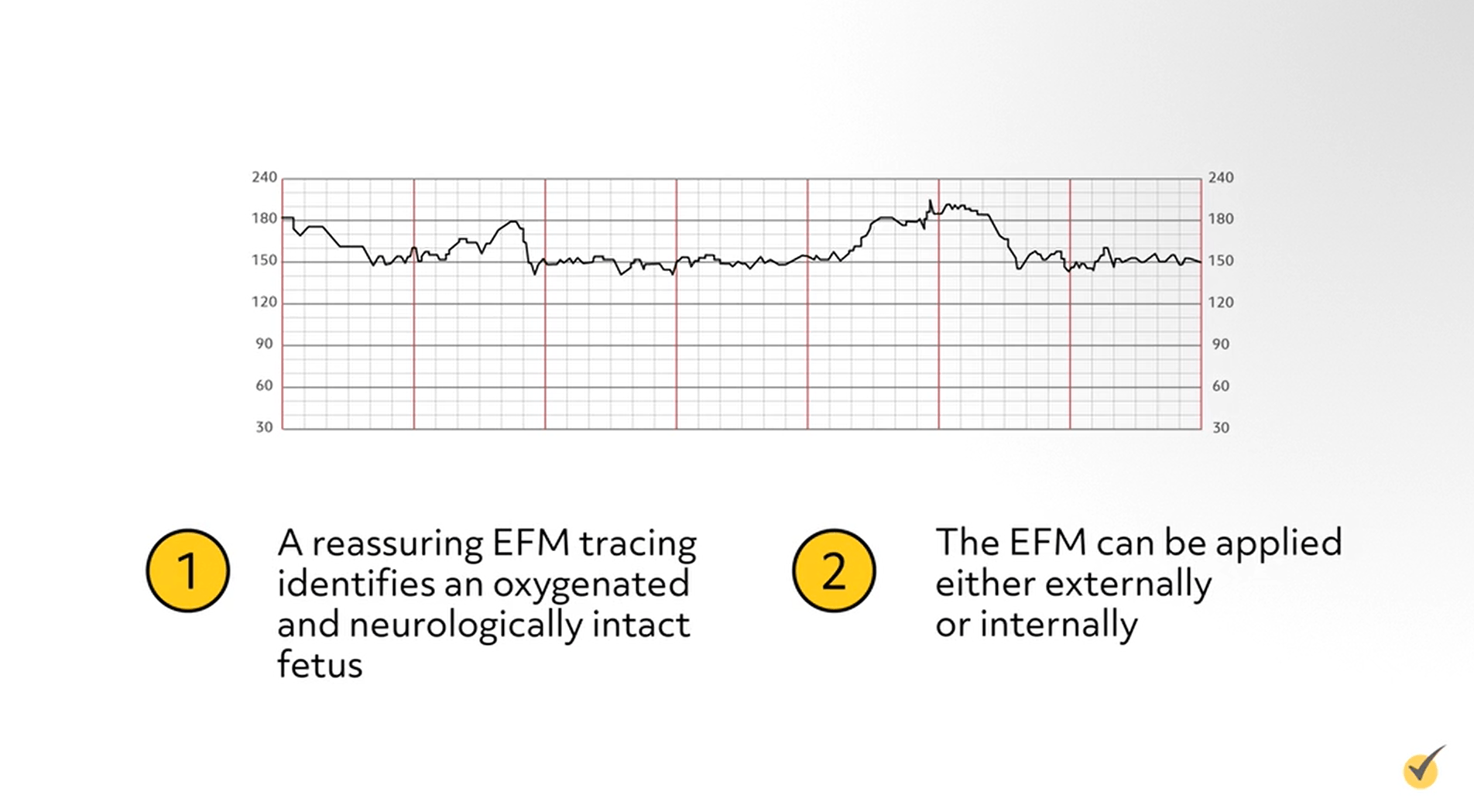 how-to-read-a-fetal-monitor-vlr-eng-br